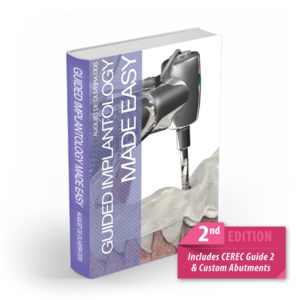 Stackable Guide Case with OnX resin and Magnetic Frame - Digital Enamel