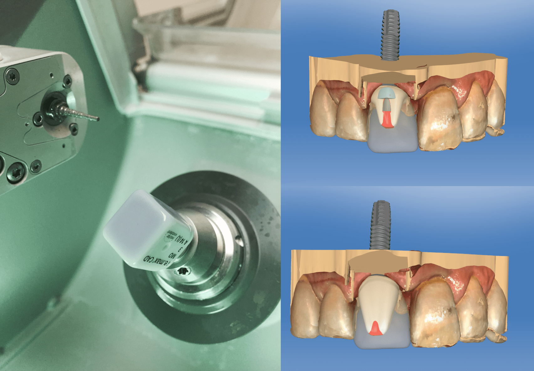 A Couple Shades Of Gray: Help with a tough Emax shade on a Legacy ...