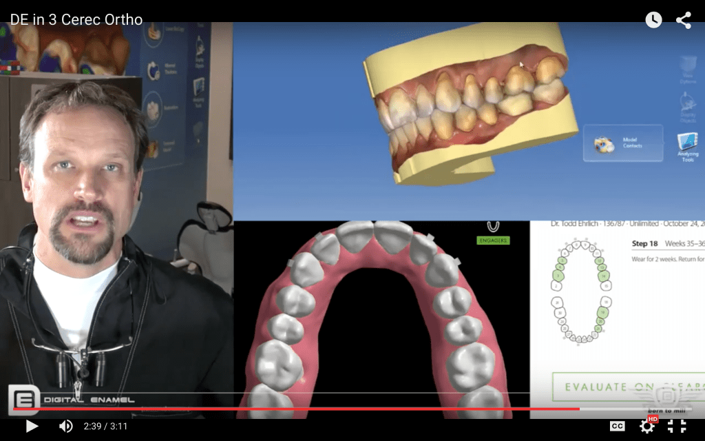 CEREC Ortho Scanning Course - Digital Enamel