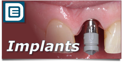 Home - Digital Enamel