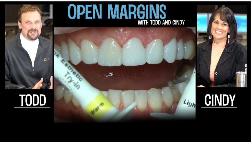 Open Margins Discusses Variolink Esthetic - Digital Enamel