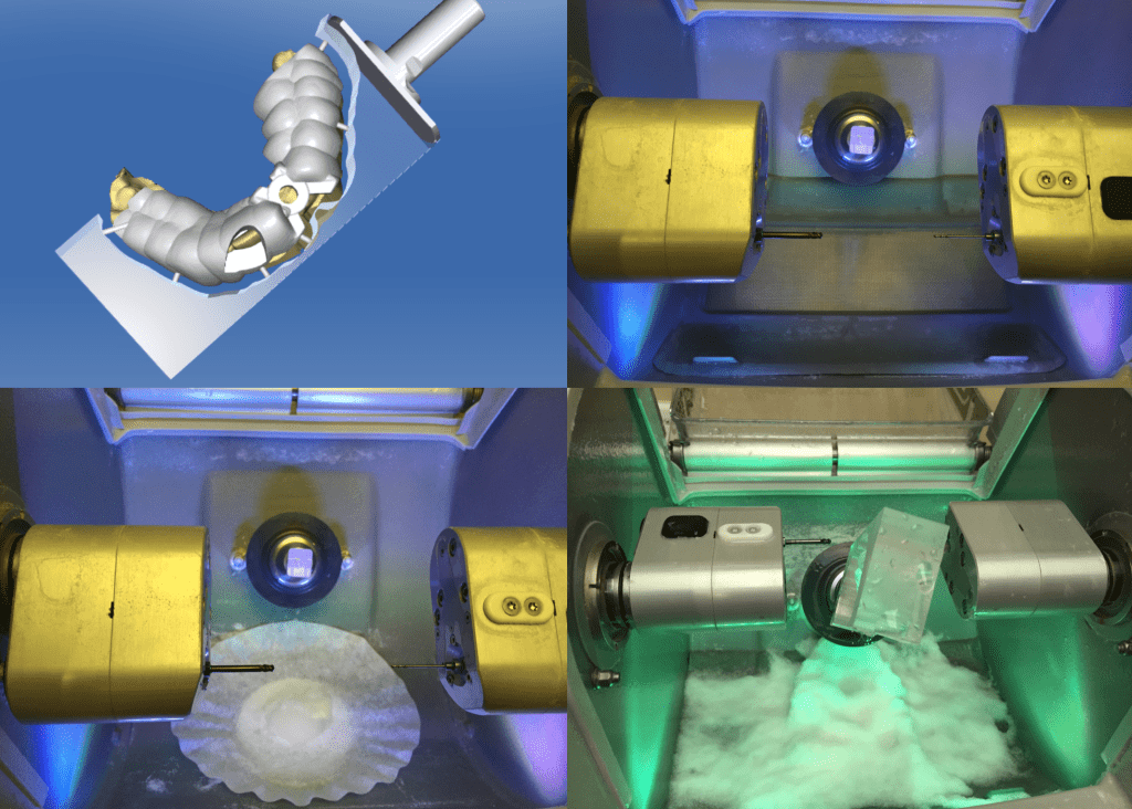 It Ain't Easy Being Cheesy: A-PRF, Telio Pre-Made Temp, Fully Guided ...