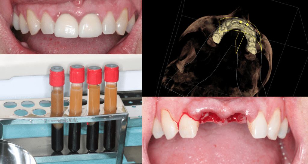 All I Want For Christmas Is..... Digital Guide/Legacy/Telio CAD Bridge ...