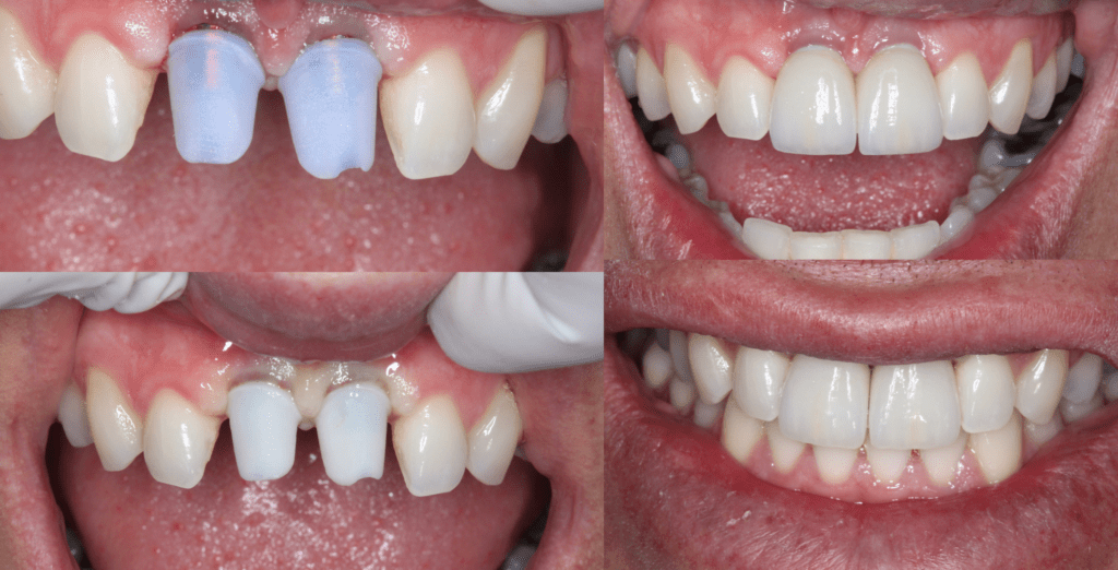 All I Want For Christmas Is..... Digital Guide/Legacy/Telio CAD Bridge ...