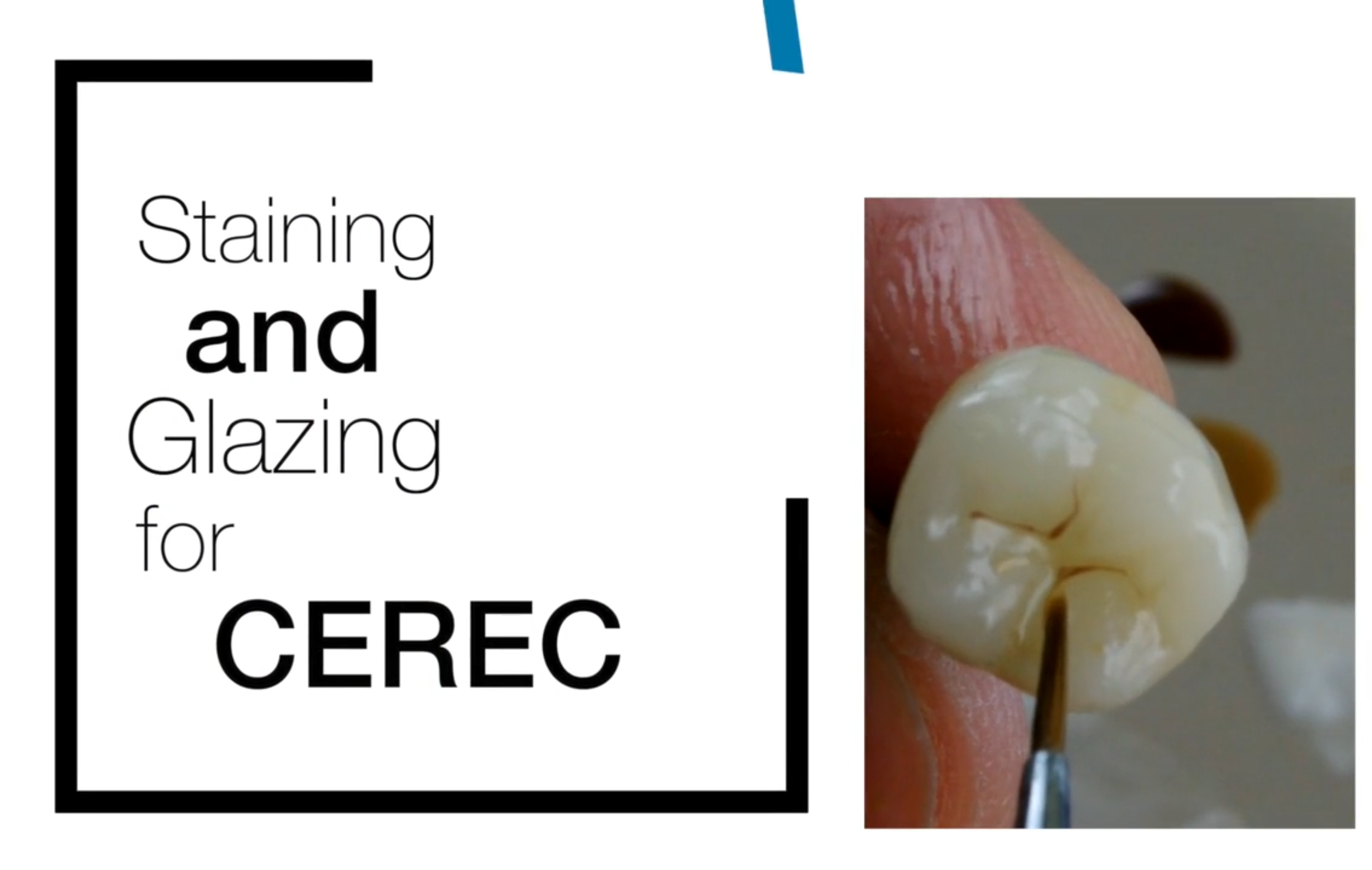 Glaze for Them, Stain for Us! - Digital Enamel