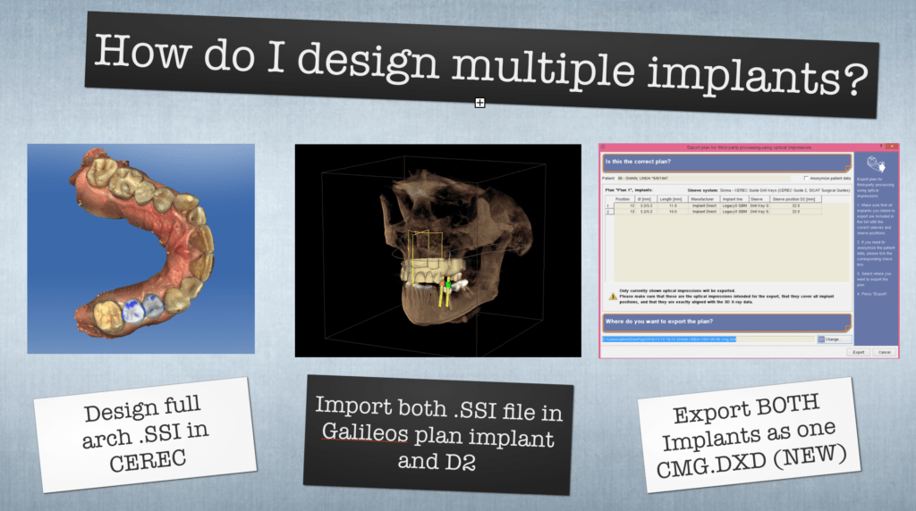 Printing CEREC Guide 2 with Multiple Implants with Form2 Printer and ...