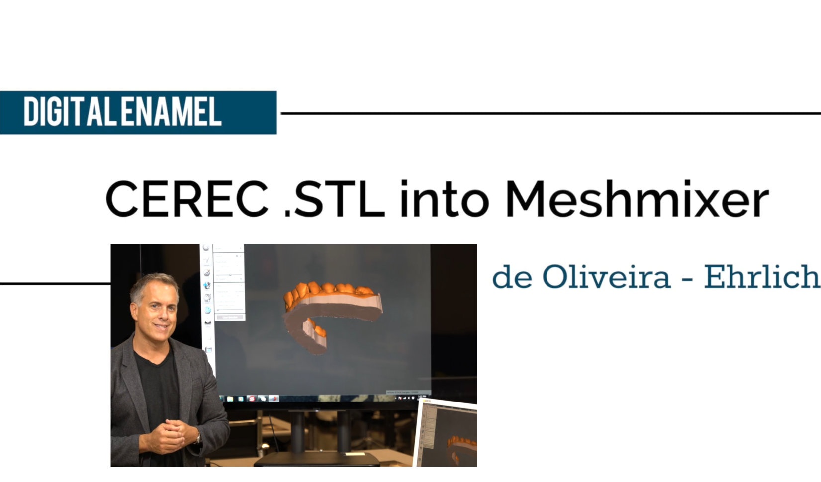 CEREC STL File Into MeshMixer - Digital Enamel