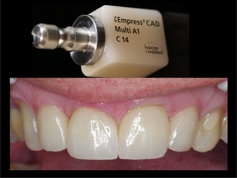 Empress MultiYear - Digital Enamel