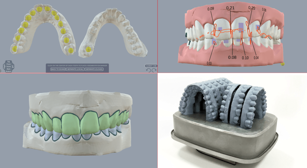 I Like to Move It Move It: In office 3D Printed aligners with Archform and Moonray - Digital Enamel