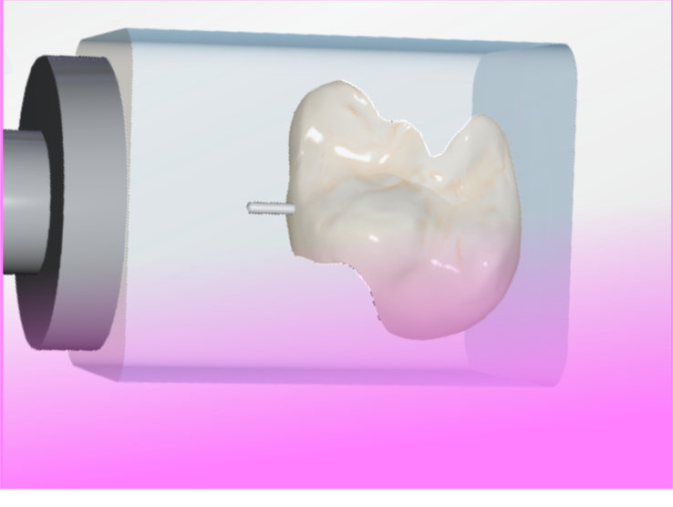 Sprue Removal Featured - Digital Enamel Sprue Removal Featured - Digital Enamel