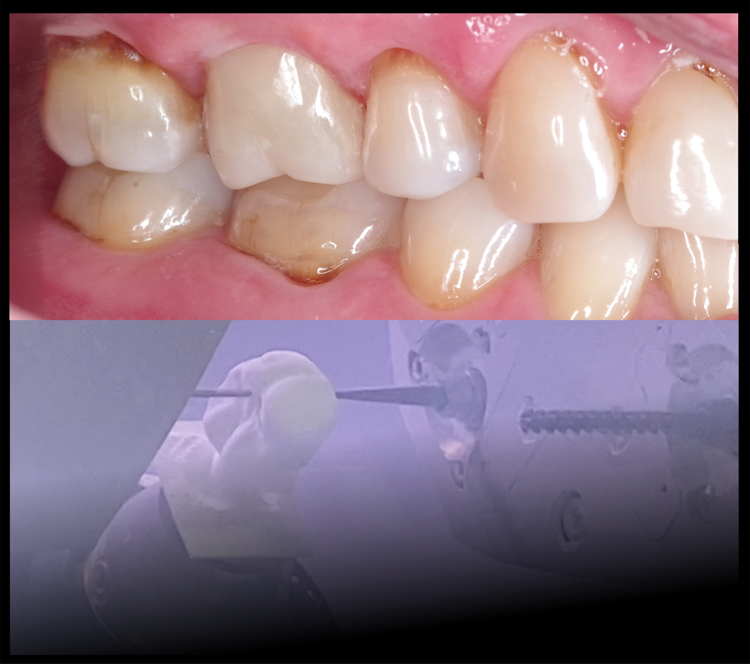 CEREC PrimeMill - Digital Enamel