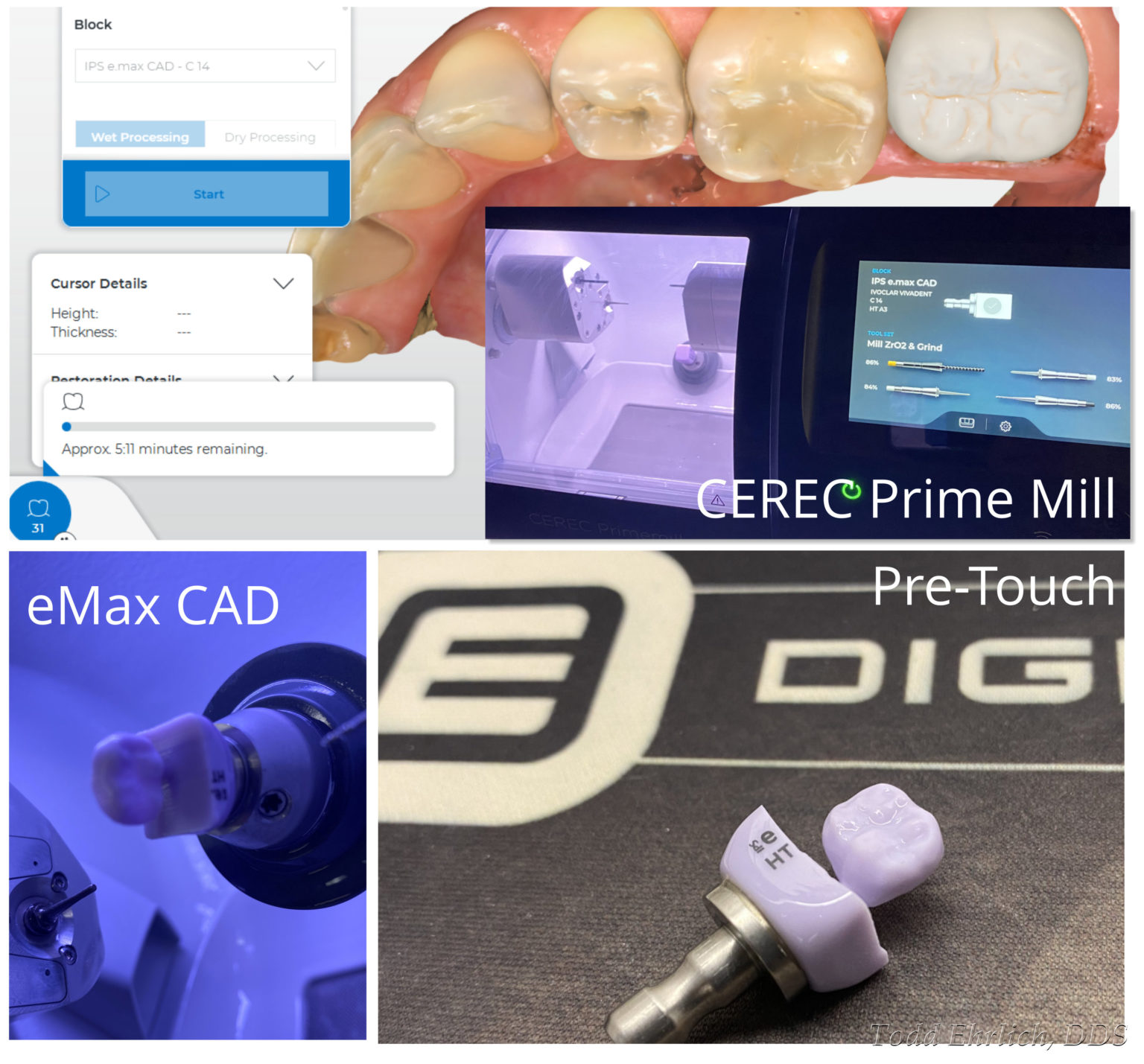 eMax Has Been Prime Milled! - Digital Enamel