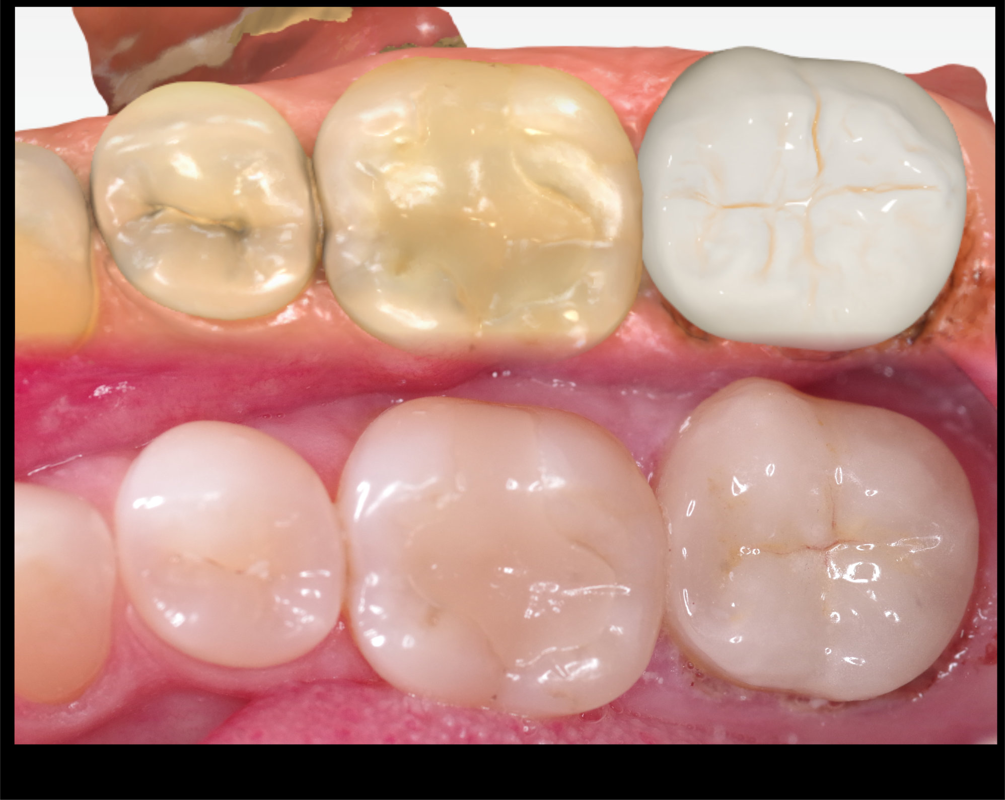 eMax Has Been Prime Milled! - Digital Enamel