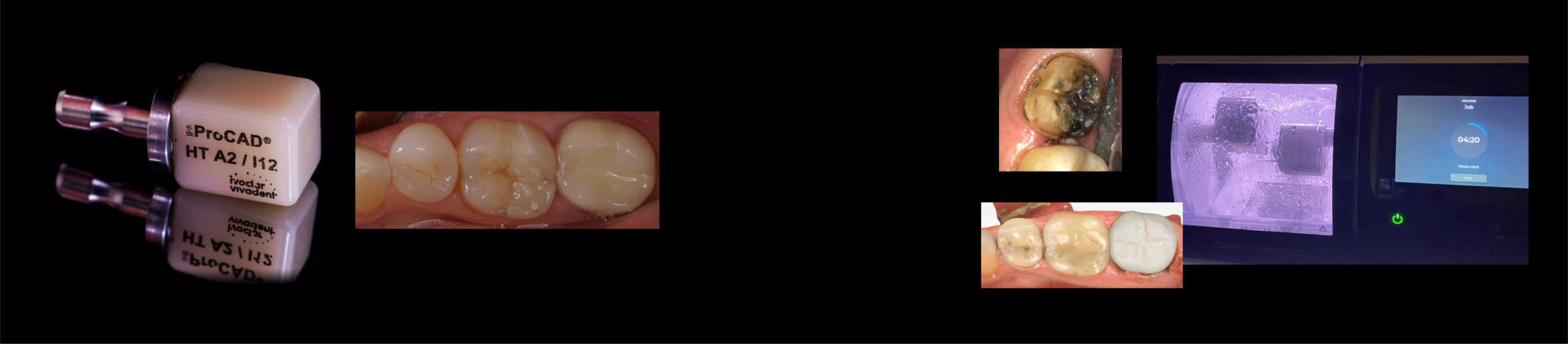 eMax Prime Milled banner - Digital Enamel